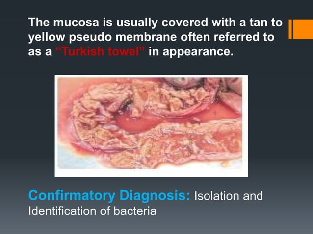Necrotic Enteritis and Duck viral Enteritis | PPTX
