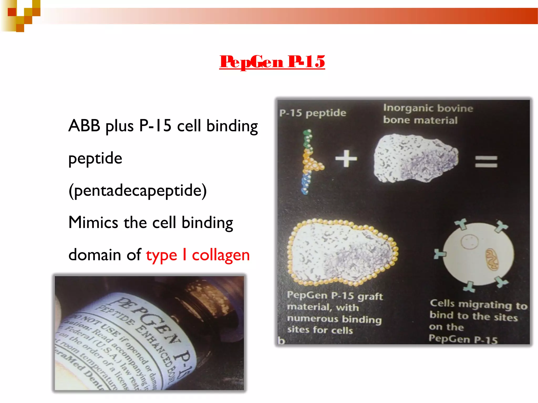 XENOGRAFTS IN DENTISTRY | PPT