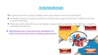 Arteriosclerosis | PPT