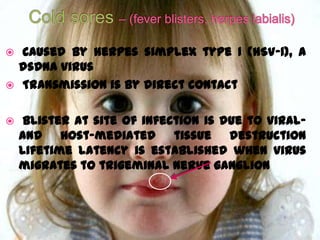 Direct Contact Diseases Due to Viruses | PPTX