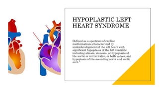 Left heart Hypoplasia.pptx