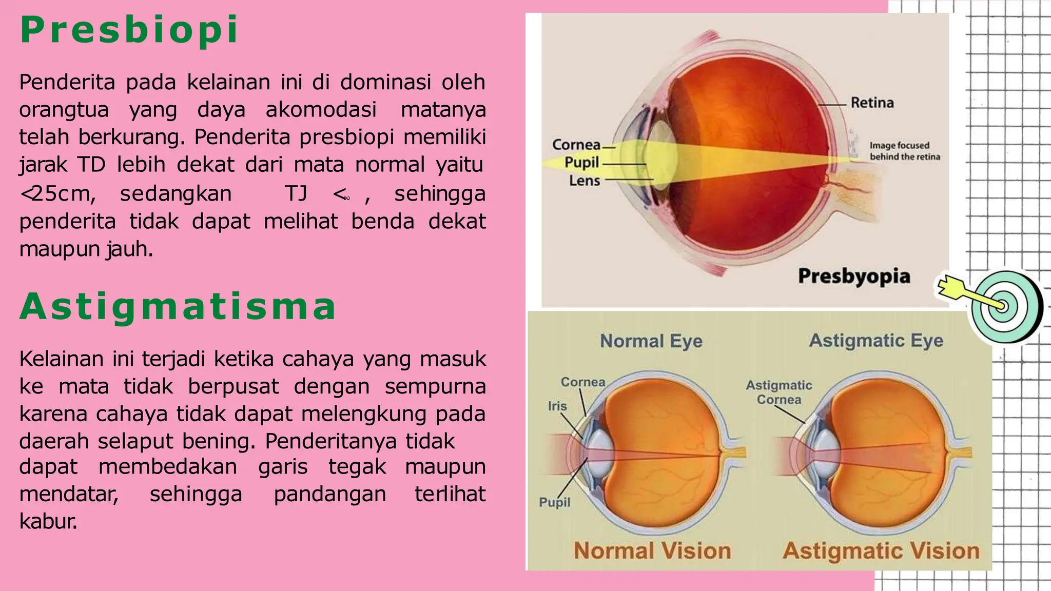 SAINS CLUB_KELAINAN MATA_Anatomi MAta.pptx