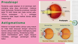 SAINS CLUB_KELAINAN MATA_Anatomi MAta.pptx