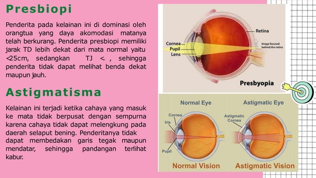 SAINS CLUB_KELAINAN MATA_Anatomi MAta.pptx