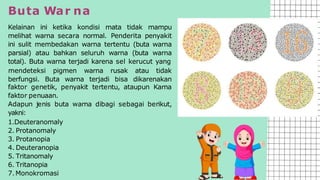 SAINS CLUB_KELAINAN MATA_Anatomi MAta.pptx