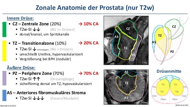 MRT der Prostata – welche Technik, wie geht PI-RADS?