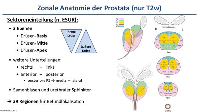 MRT der Prostata – welche Technik, wie geht PI-RADS?