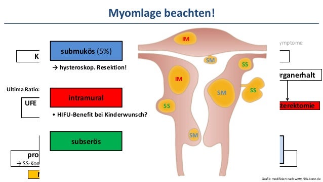 Nicht-operative Therapieoptionen bei Uterusmyomen – was leisten MRgFU…