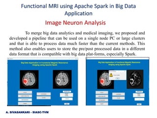 Functional MRI using Apache Spark in Big Data Application | PPT