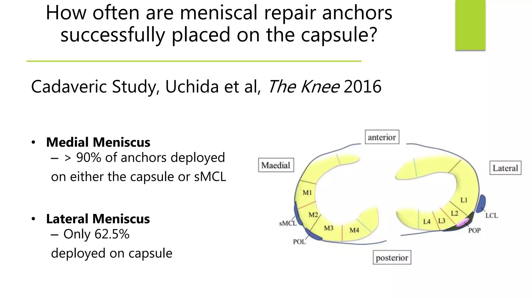 Popliteus is a safe location for all-inside meniscal repair devices in ...