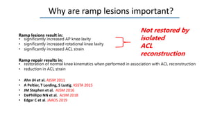 Ramp lesions in the ACL-Injured Knee | PPTX