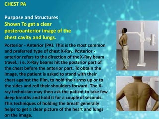 Ppt on chest radiography.pptx