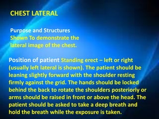 Ppt on chest radiography.pptx