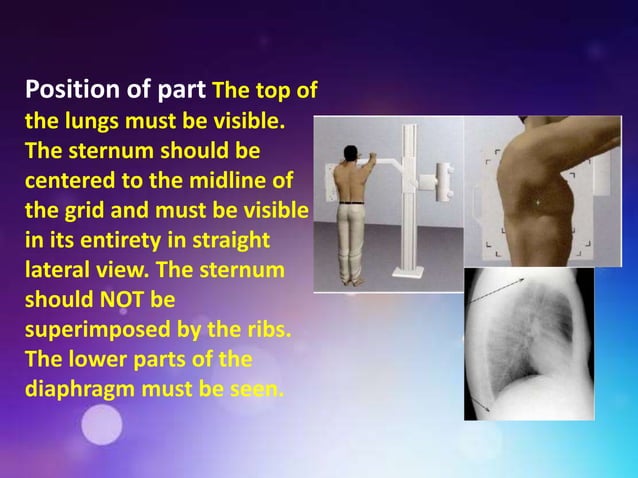 Ppt on chest radiography.pptx