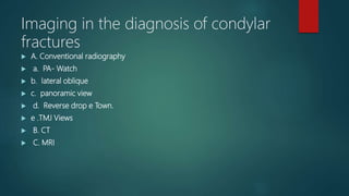 Condylar fracture | PPTX