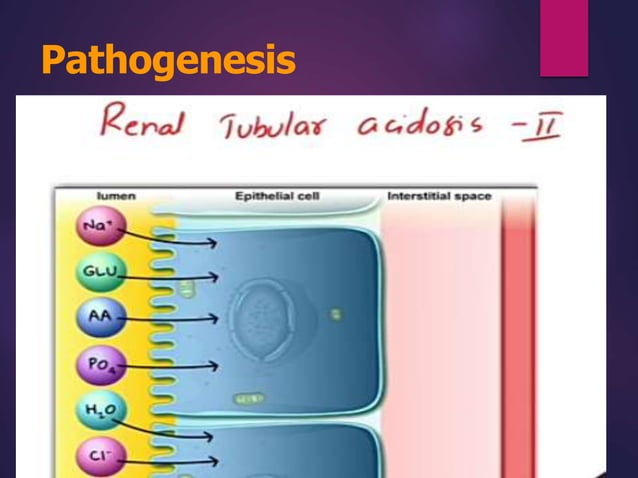 RENAL TUBULAR ACIDOSIS | PPTX | Endocrine and Metabolic Diseases ...