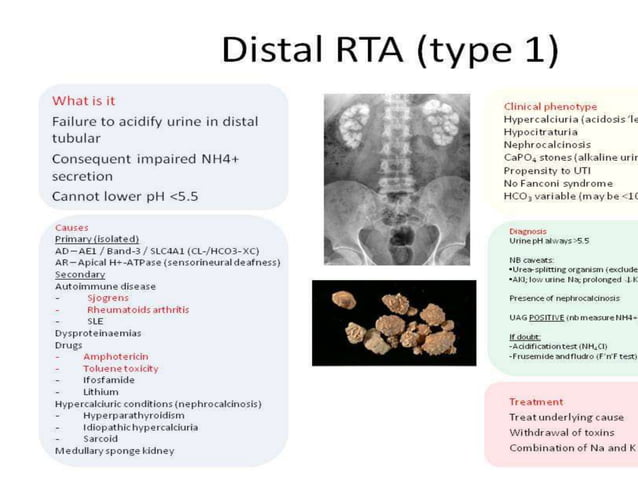 RENAL TUBULAR ACIDOSIS | PPTX | Endocrine and Metabolic Diseases ...