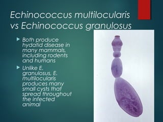 echinococcus | PPT