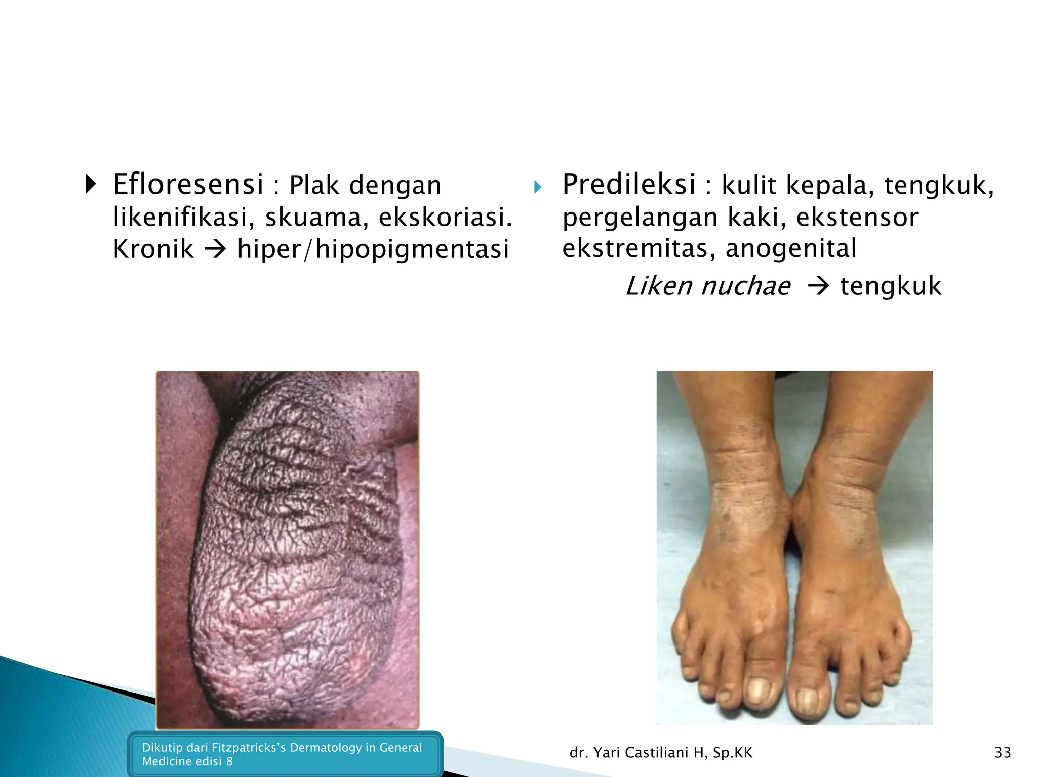 Sakit kulit ini membunuhku dermatitis.ppt