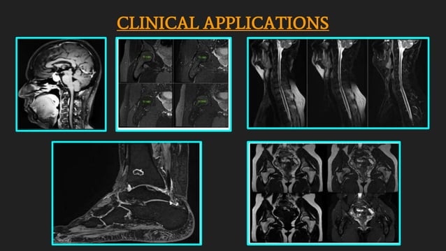 Fat suppression techniques in MRI | PPTX | Chemistry | Science