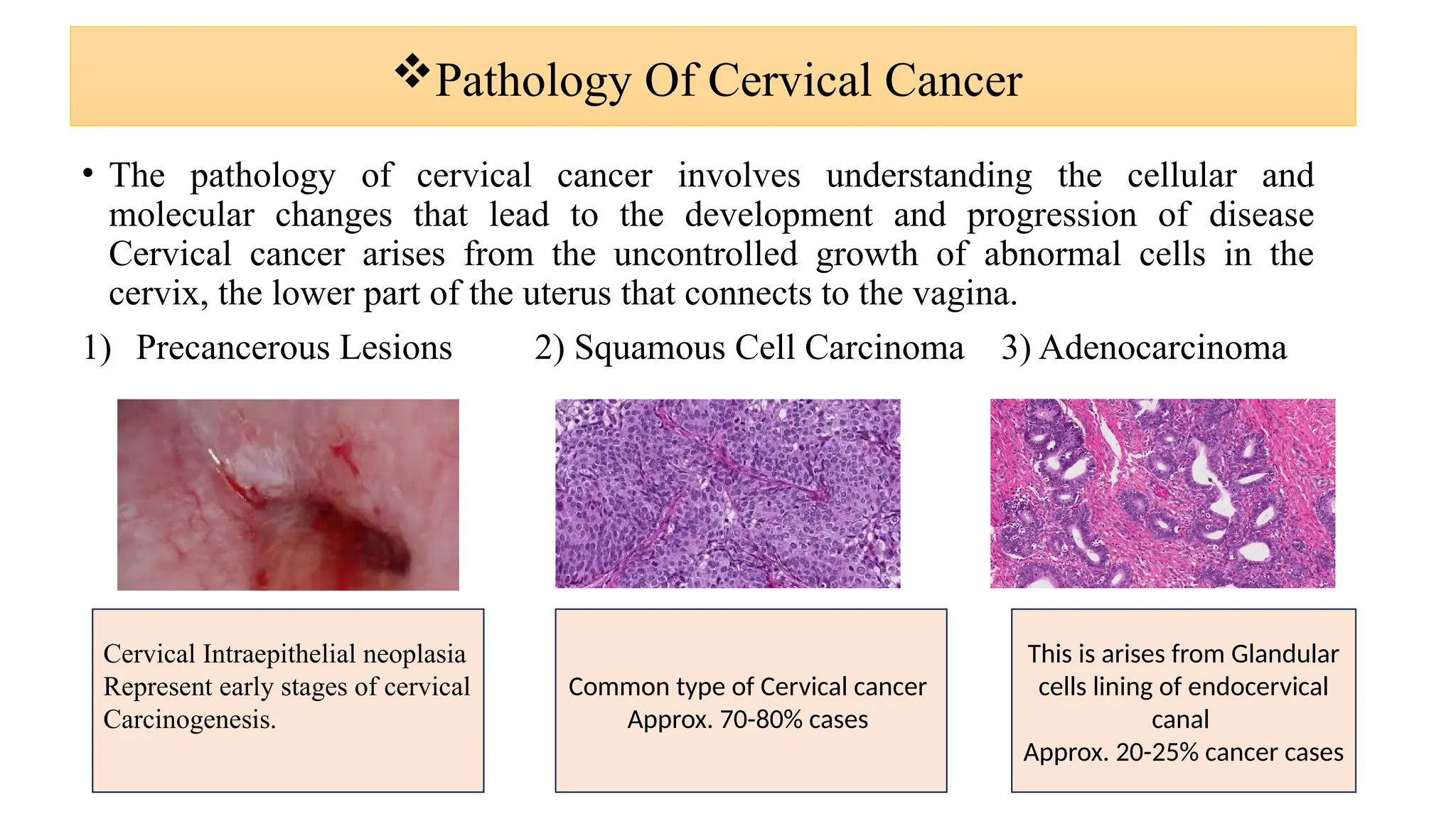 A Comprehensive Review of Cervical Cancer | PPTX