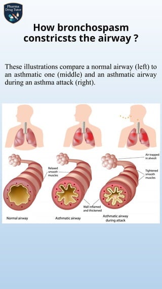 Salbutamol (Albuterol): Mechanism of action, Uses & Safety | PPTX