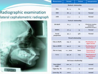 Saleh presentation | PPT