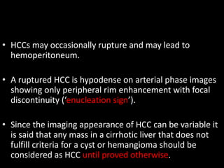 Imaging of Malignant Liver Lesions | PPTX