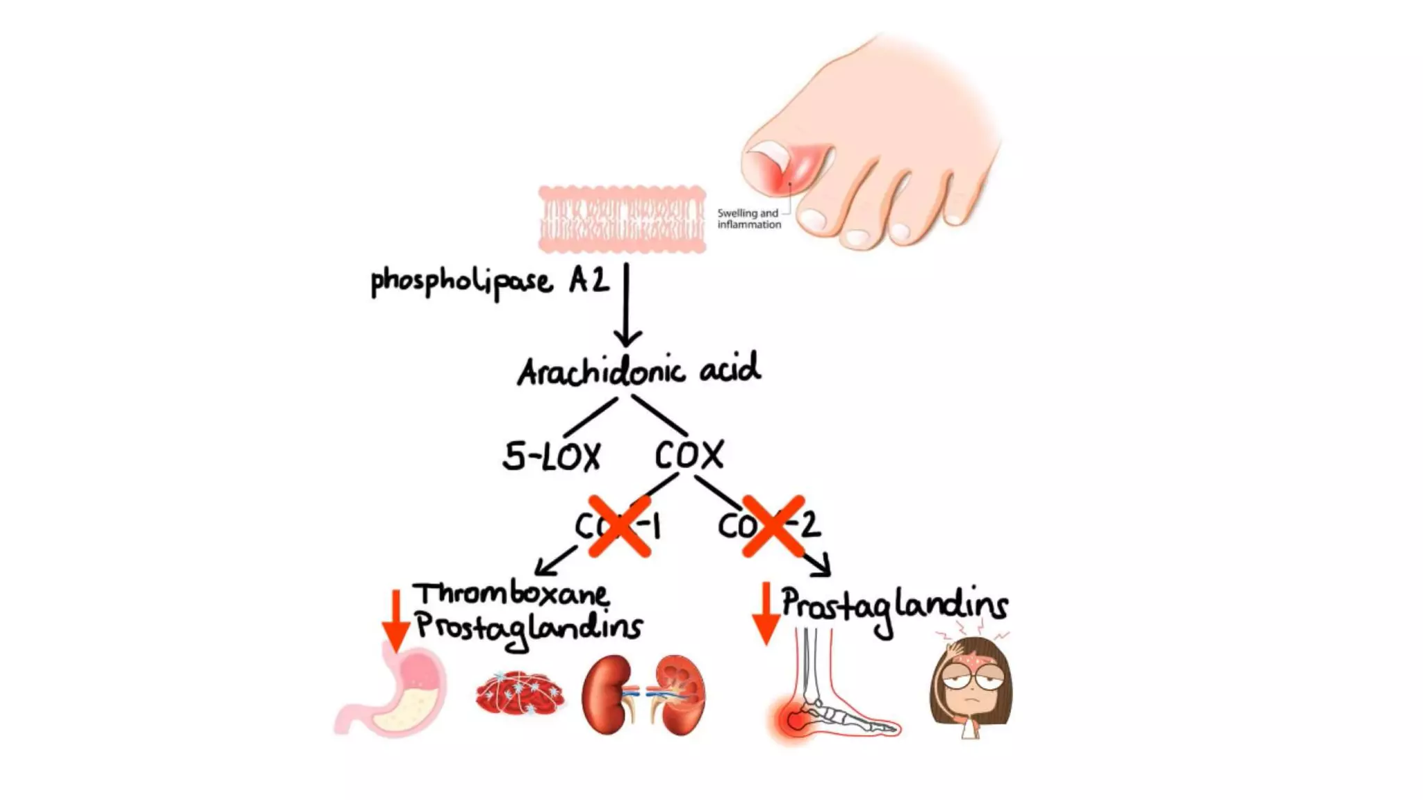 Salicylate poisoning | PPTX