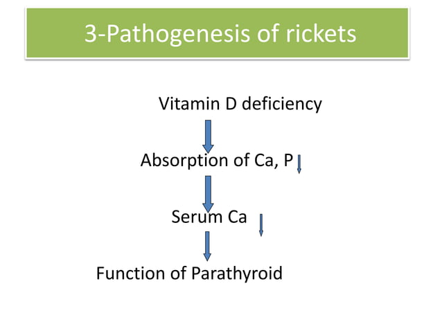 Approach to a child with Rickets | PPTX