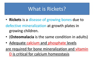Approach to a child with Rickets | PPTX