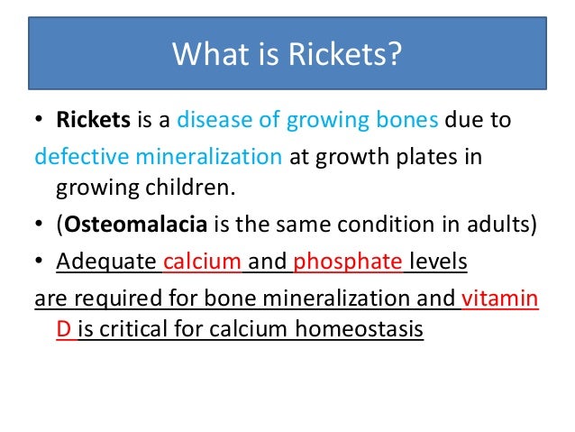 Approach to a child with Rickets