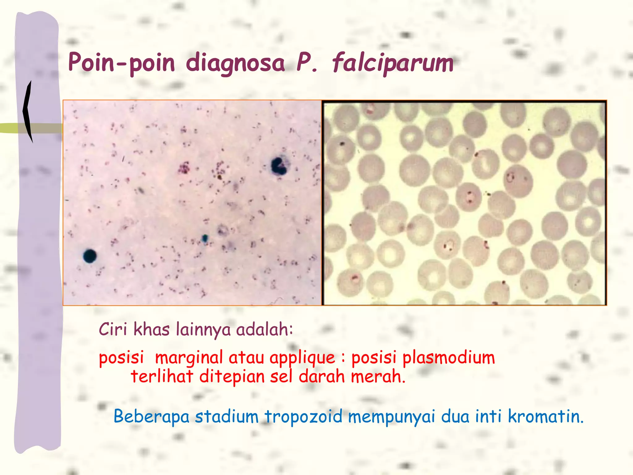 Salinan DIDIK MM Pengenalan jenis stadium & morfologi plasmodium ...