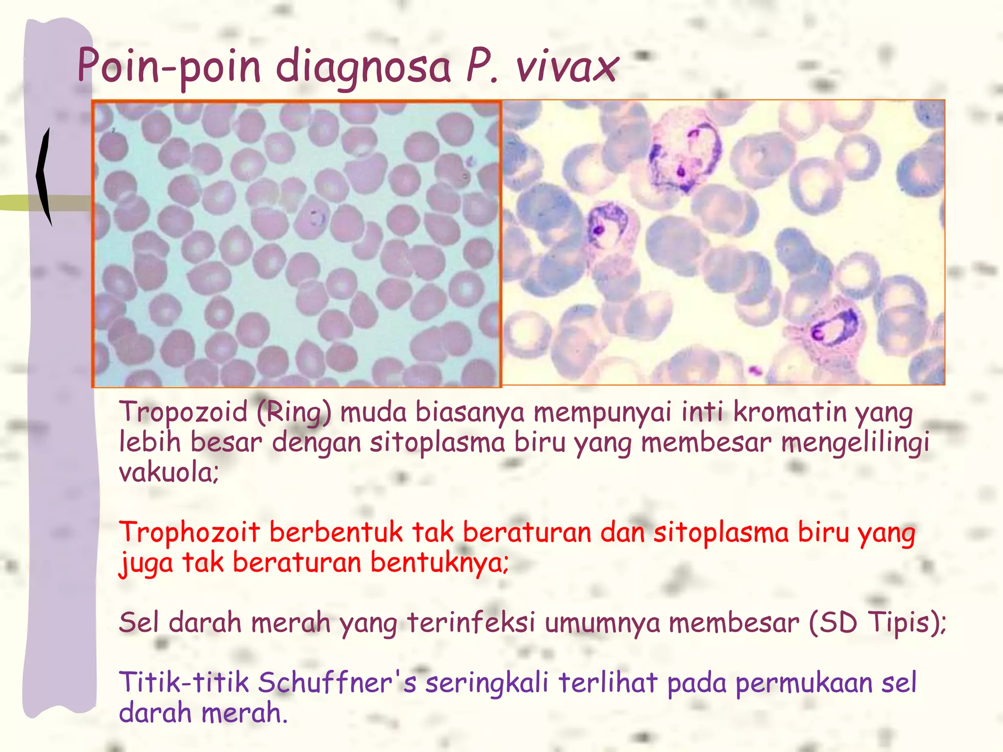 Salinan DIDIK MM Pengenalan jenis stadium & morfologi plasmodium ...