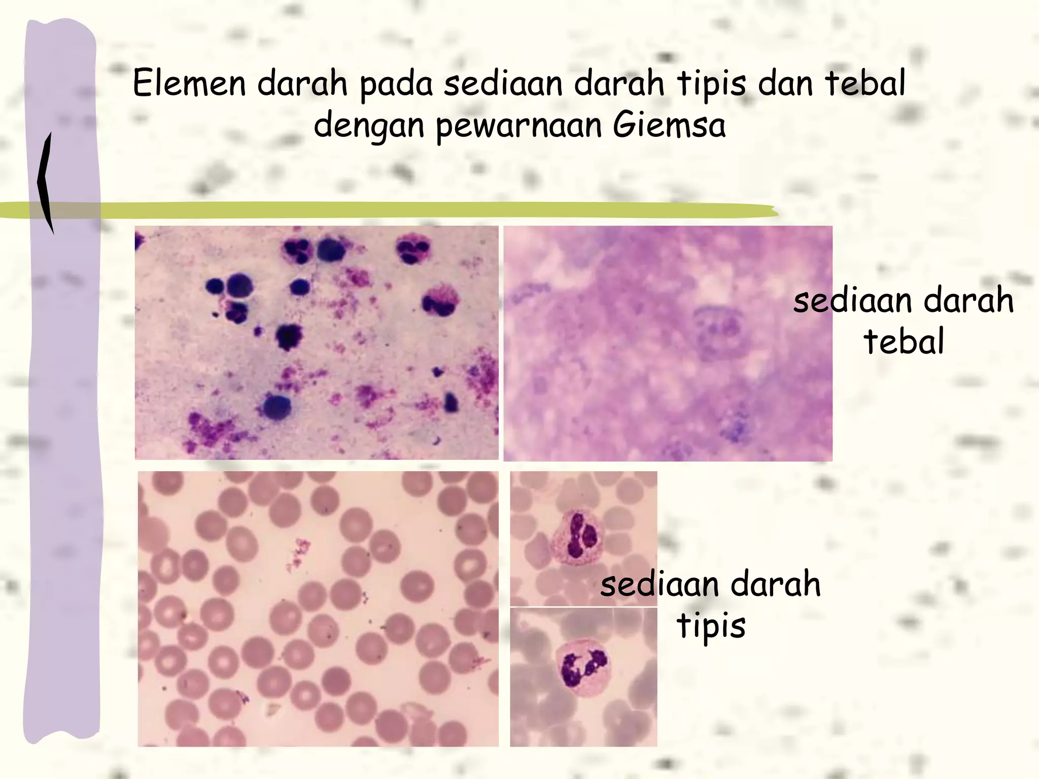 Salinan DIDIK MM Pengenalan jenis stadium & morfologi plasmodium ...