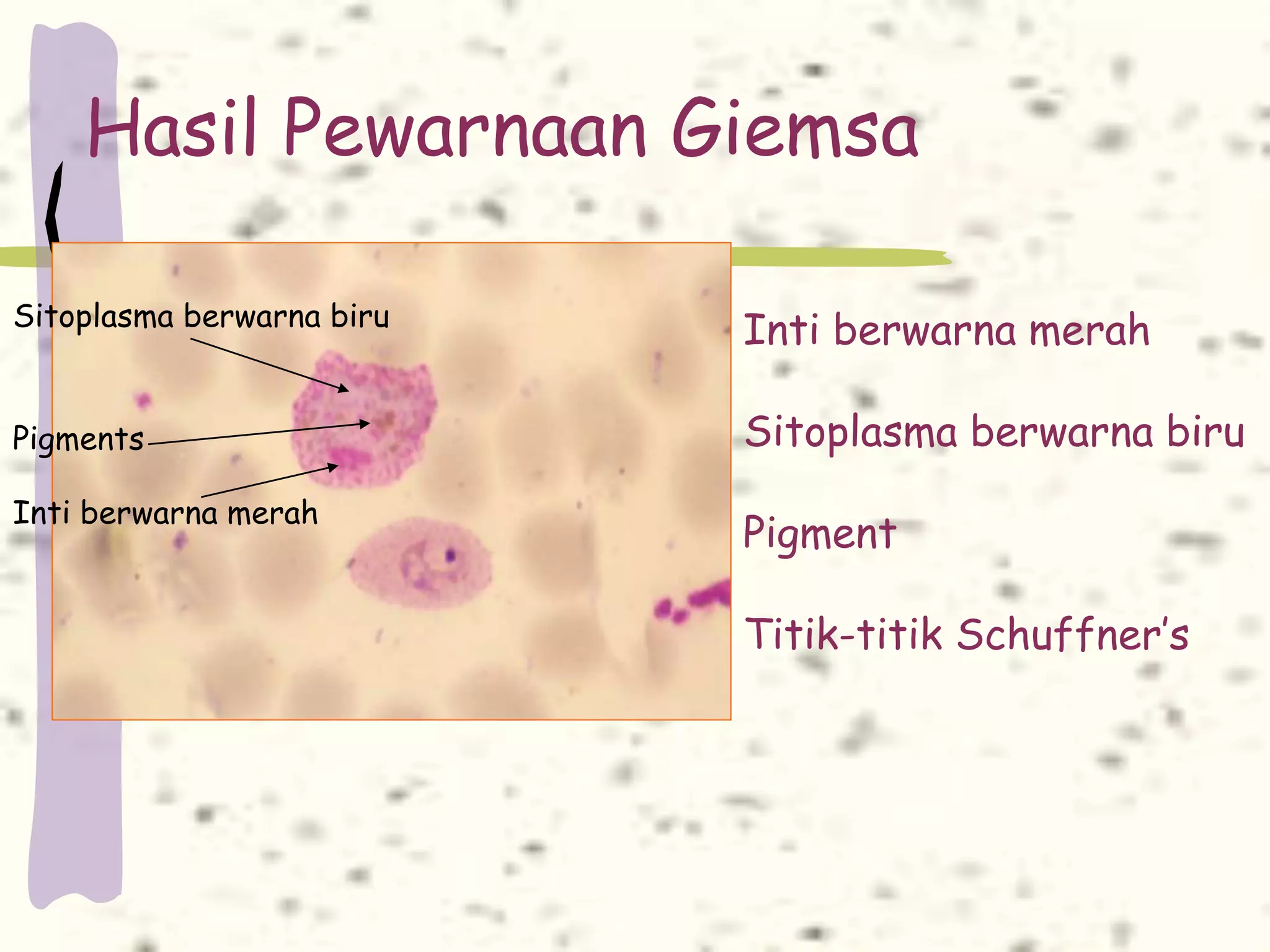 Salinan DIDIK MM Pengenalan jenis stadium & morfologi plasmodium ...