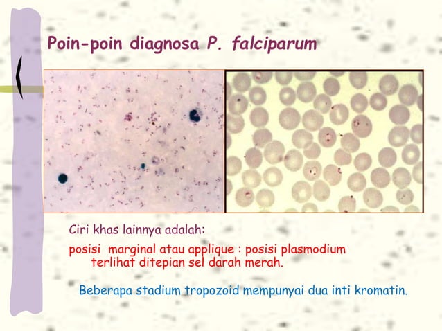 Salinan DIDIK MM Pengenalan jenis stadium & morfologi plasmodium malaria (1).pptx