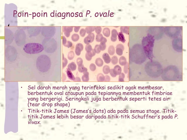 Salinan DIDIK MM Pengenalan jenis stadium & morfologi plasmodium malaria (1).pptx