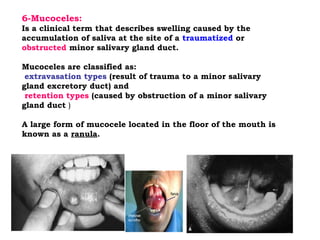 Saliva.gland lect. | PPT
