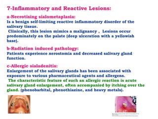 Saliva.gland lect. | PPT
