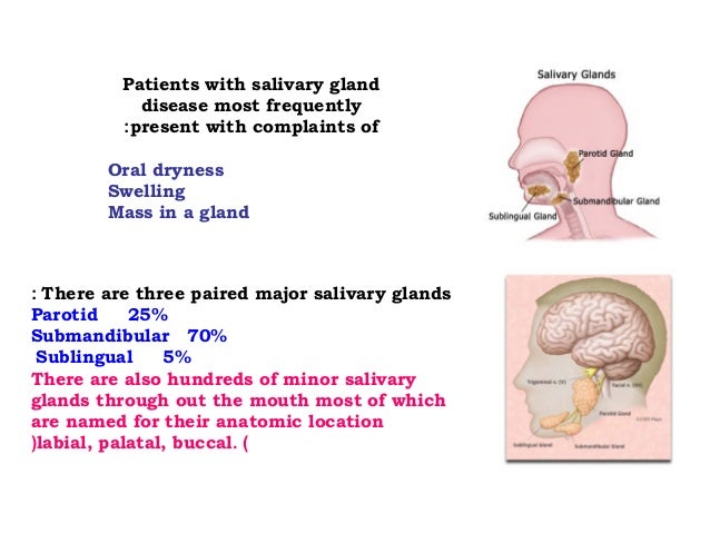 Sublingual Salivary Gland Duct Treatment