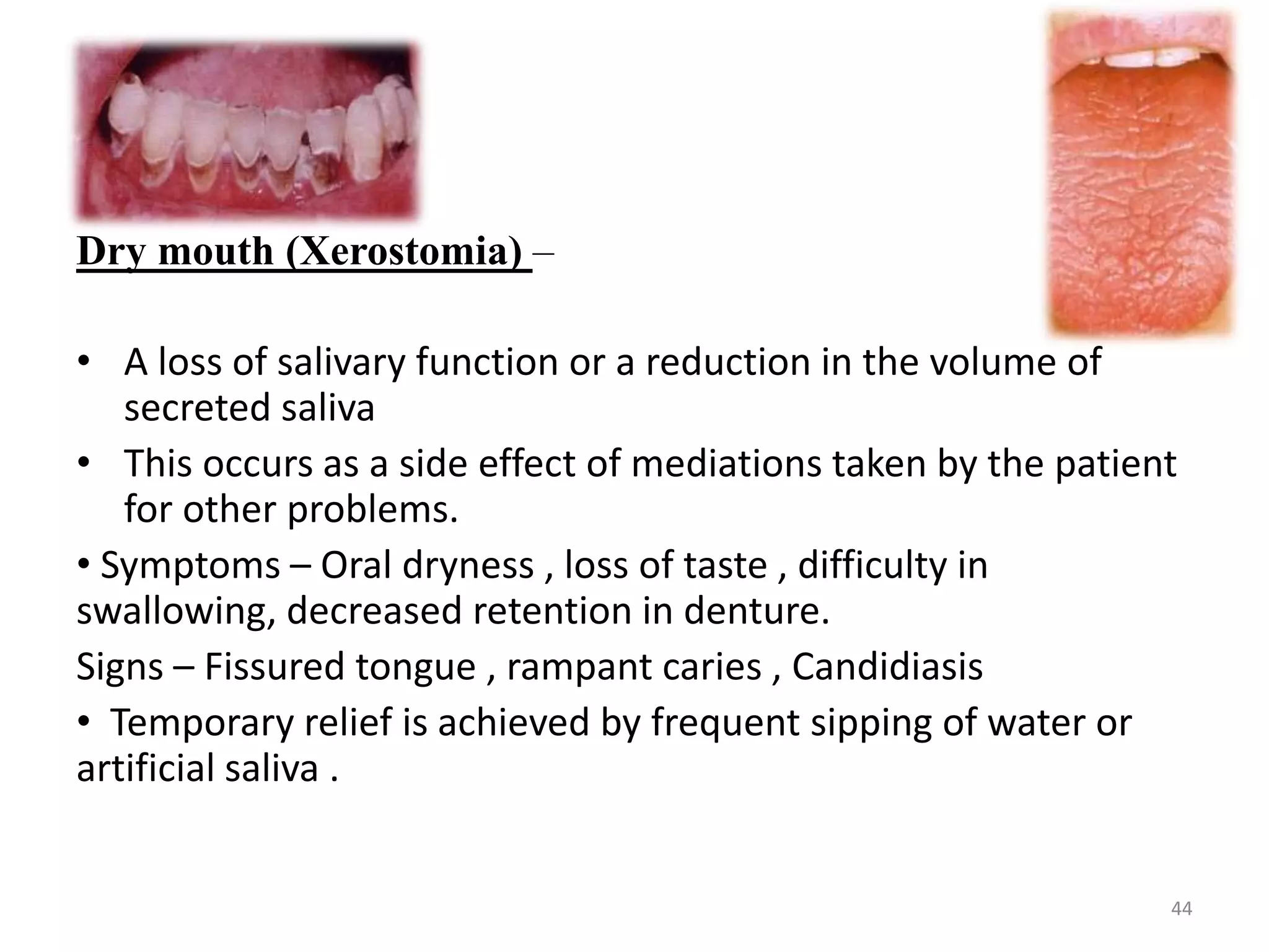 Saliva | PPTX