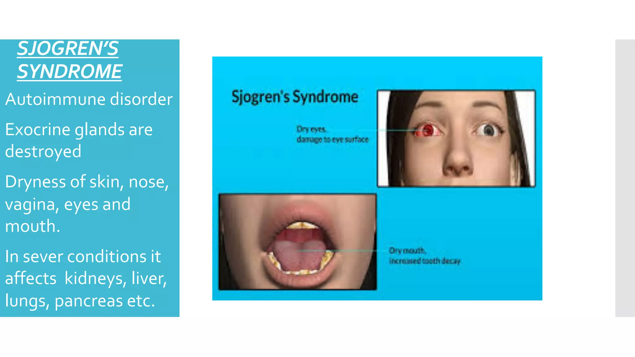 Salivation- GIT physiology | PDF