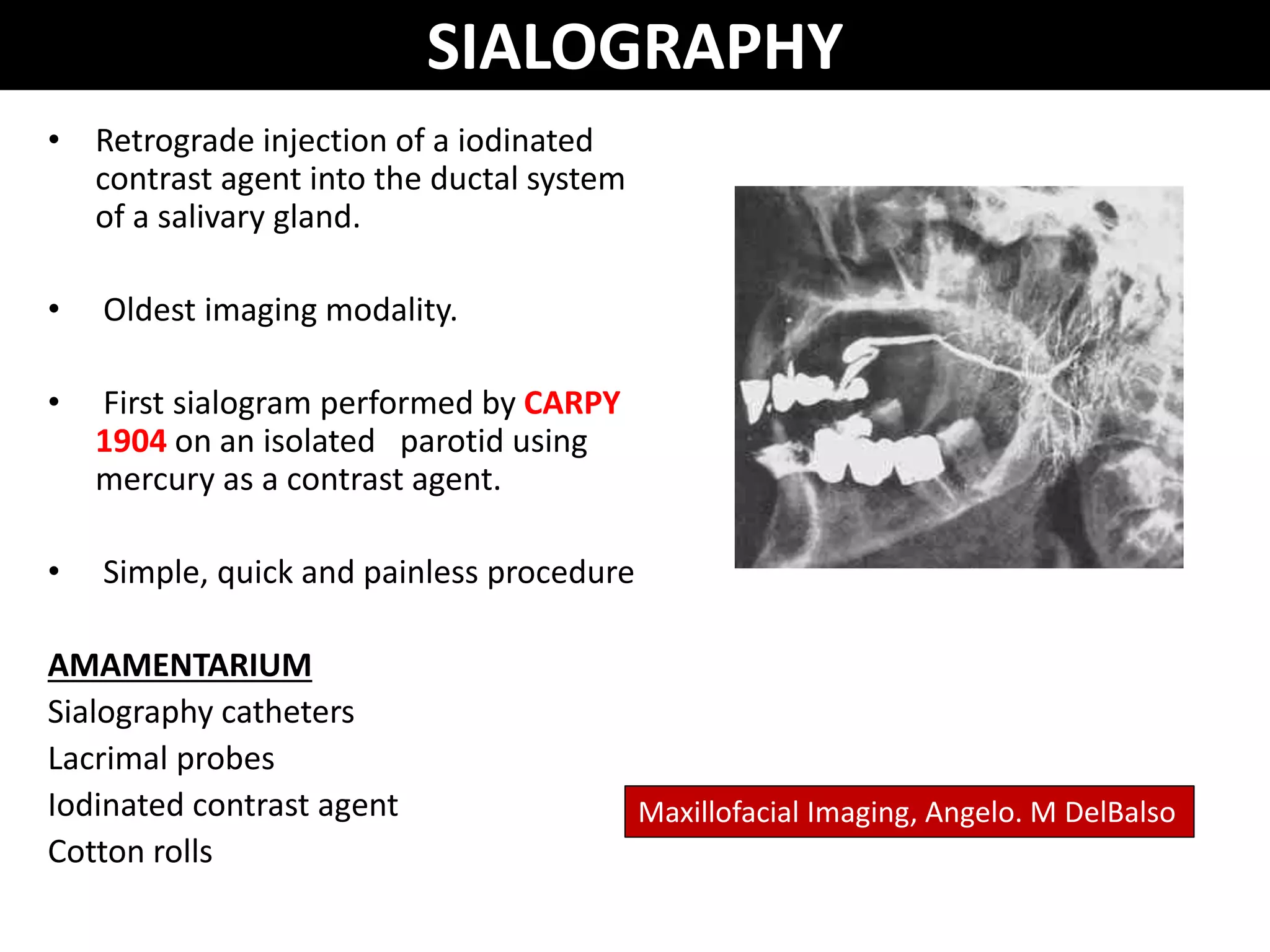 Saliva and salivary glands | PPTX