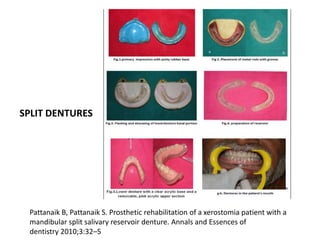 Saliva and salivary glands | PPTX