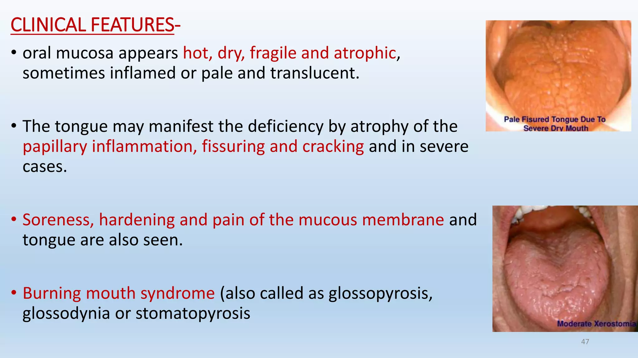 Saliva in prosthodontics | PPTX