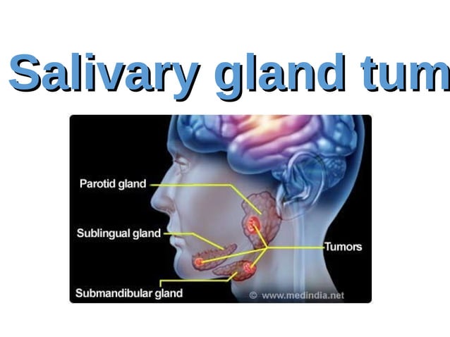Salivary Glands Anatomy & Inflammation & Tumors | PPT