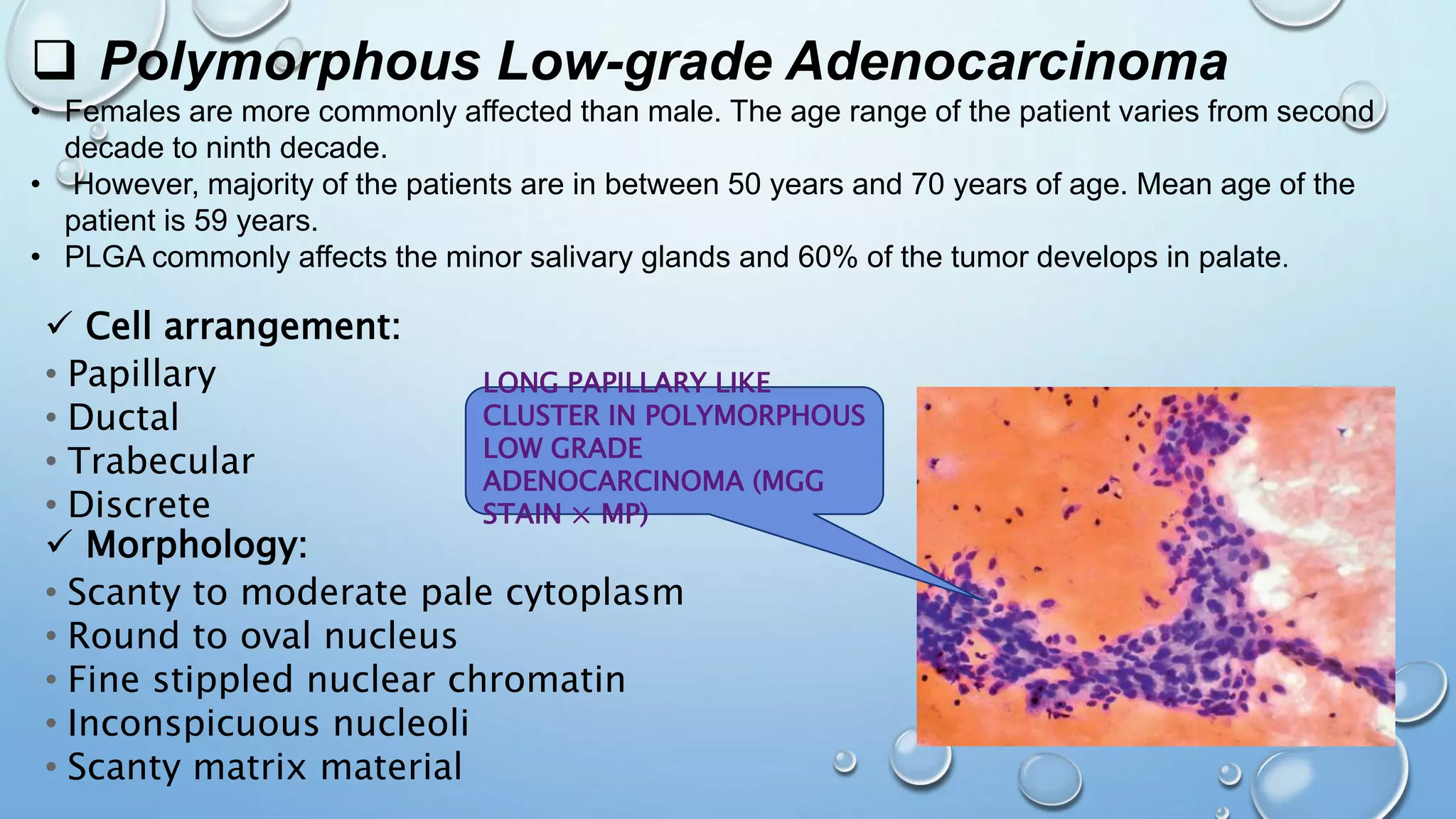 Salivary gland-- cytology .pptx