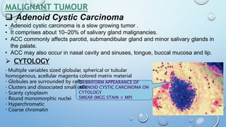 Salivary gland-- cytology .pptx