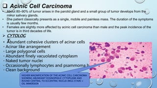 Salivary gland-- cytology .pptx